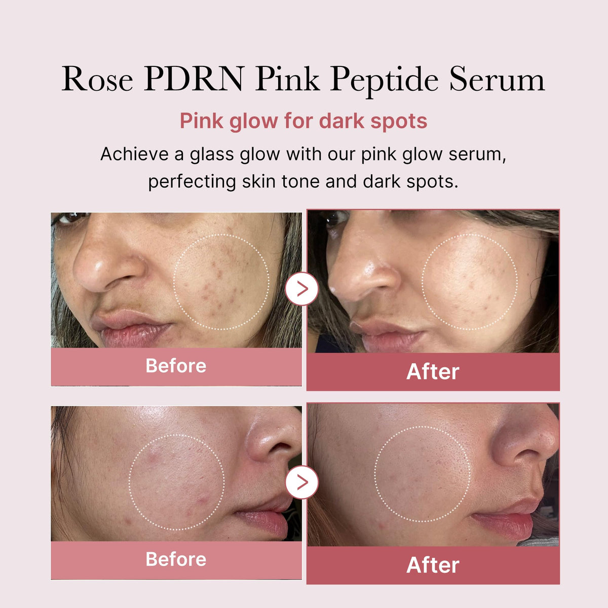 Medicube PDRN Pink One Day Serum Set – Glowup Oman